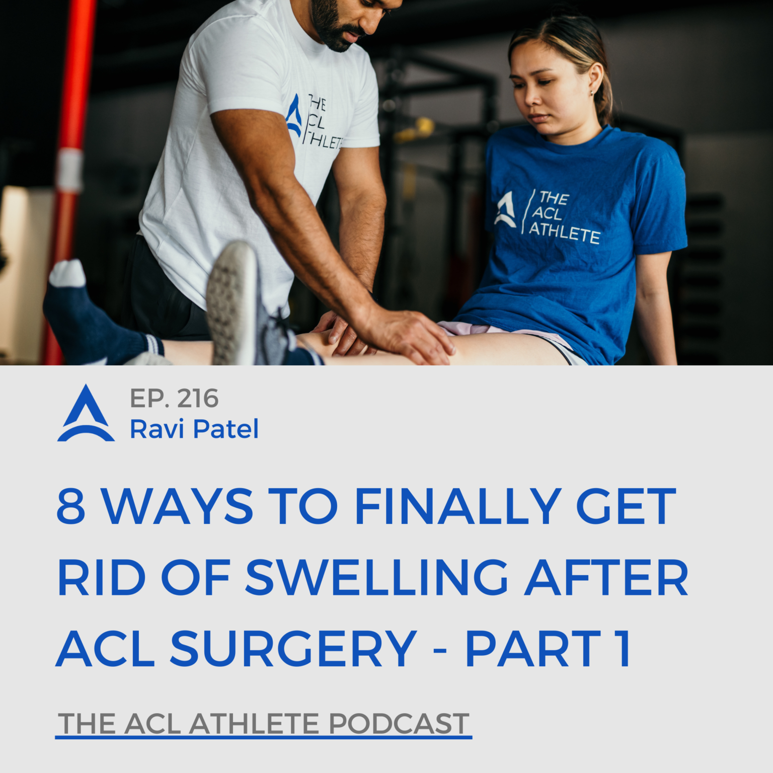 Episode 216 | 8 Ways to Finally Get Rid of Swelling After ACL Surgery ...