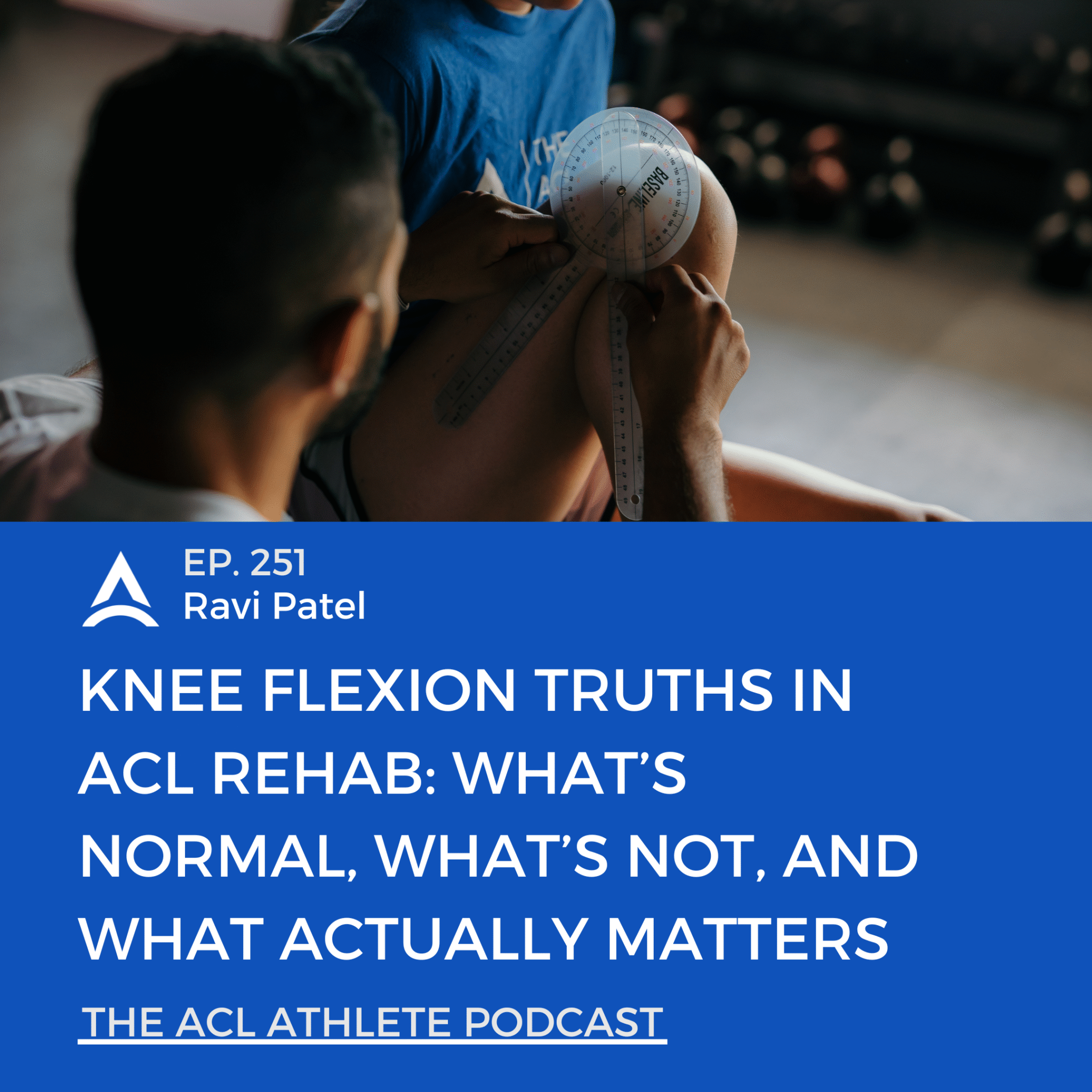 Episode 251 | Knee Flexion Truths in ACL Rehab: What’s Normal, What’s ...